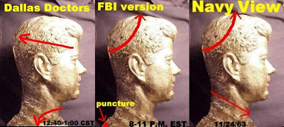 Debunking the Debunkers: The JFK Assassination Autopsy Cover-up; Only ...